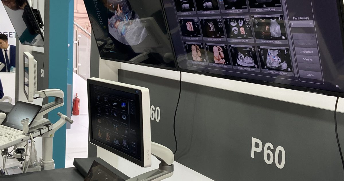 Sonoscape lanceert P60 ! | DL Medical